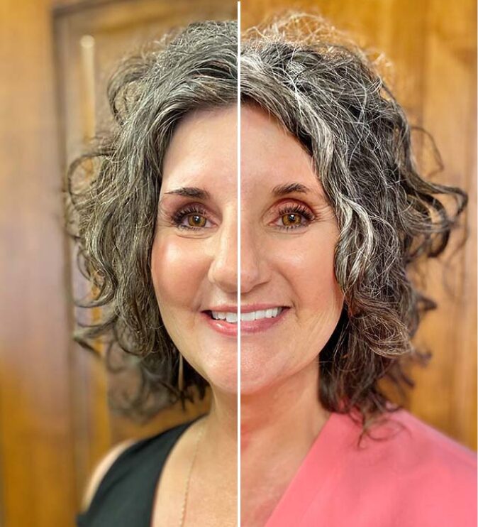 Smile Gallery & Dental Results | East Cobb, GA | Cheek Dental